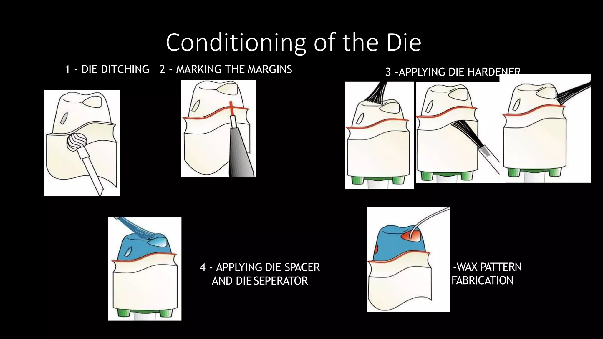 Casting procedures | PPTX