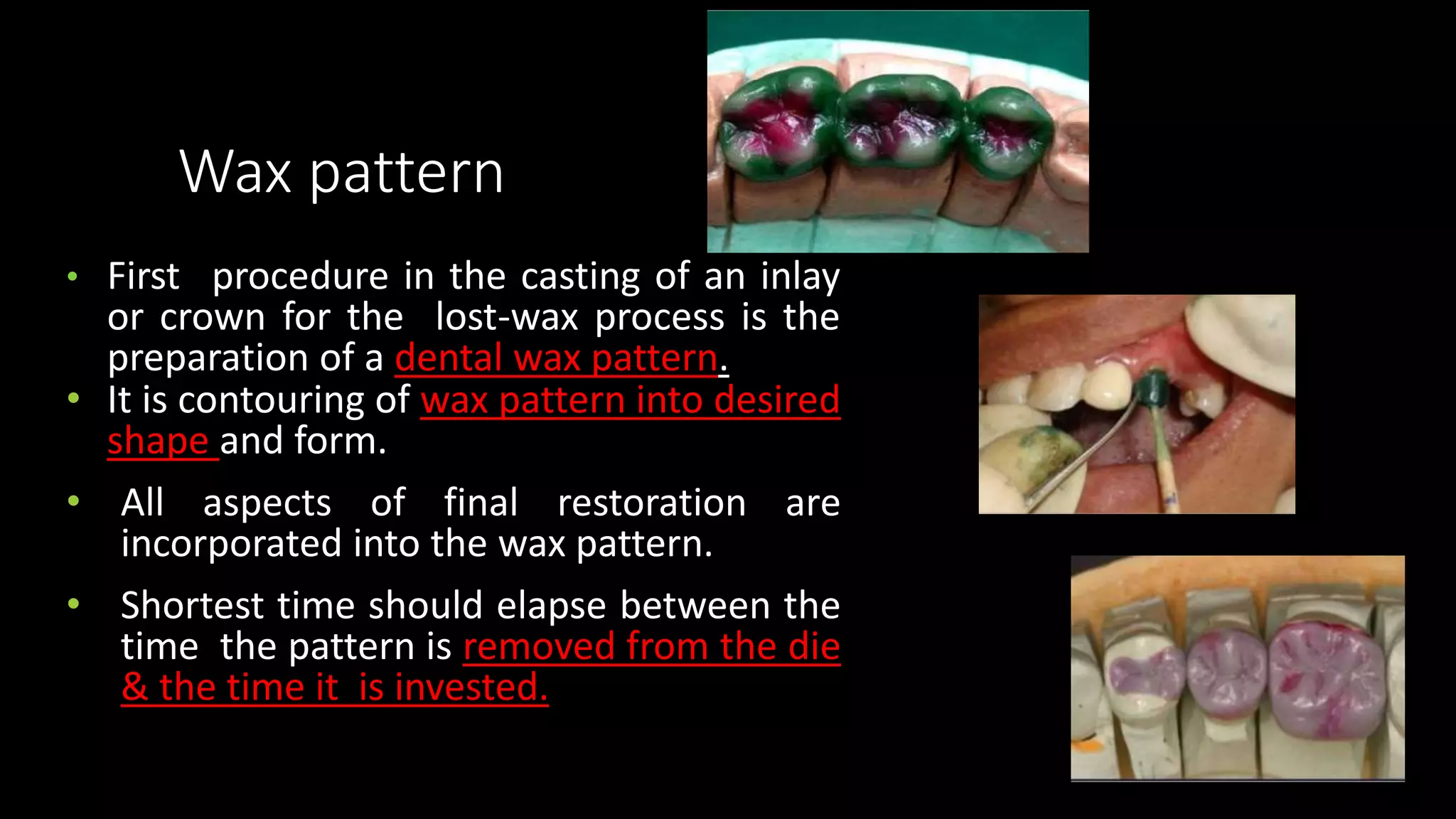 Casting procedures | PPTX