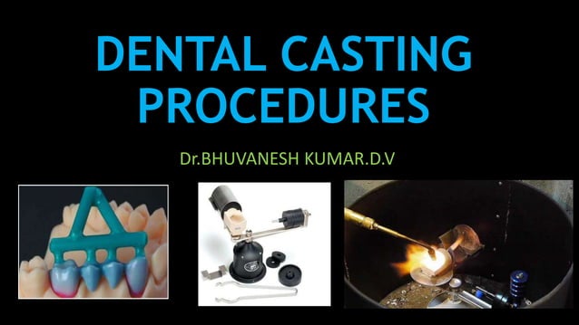 Casting procedures | PPTX