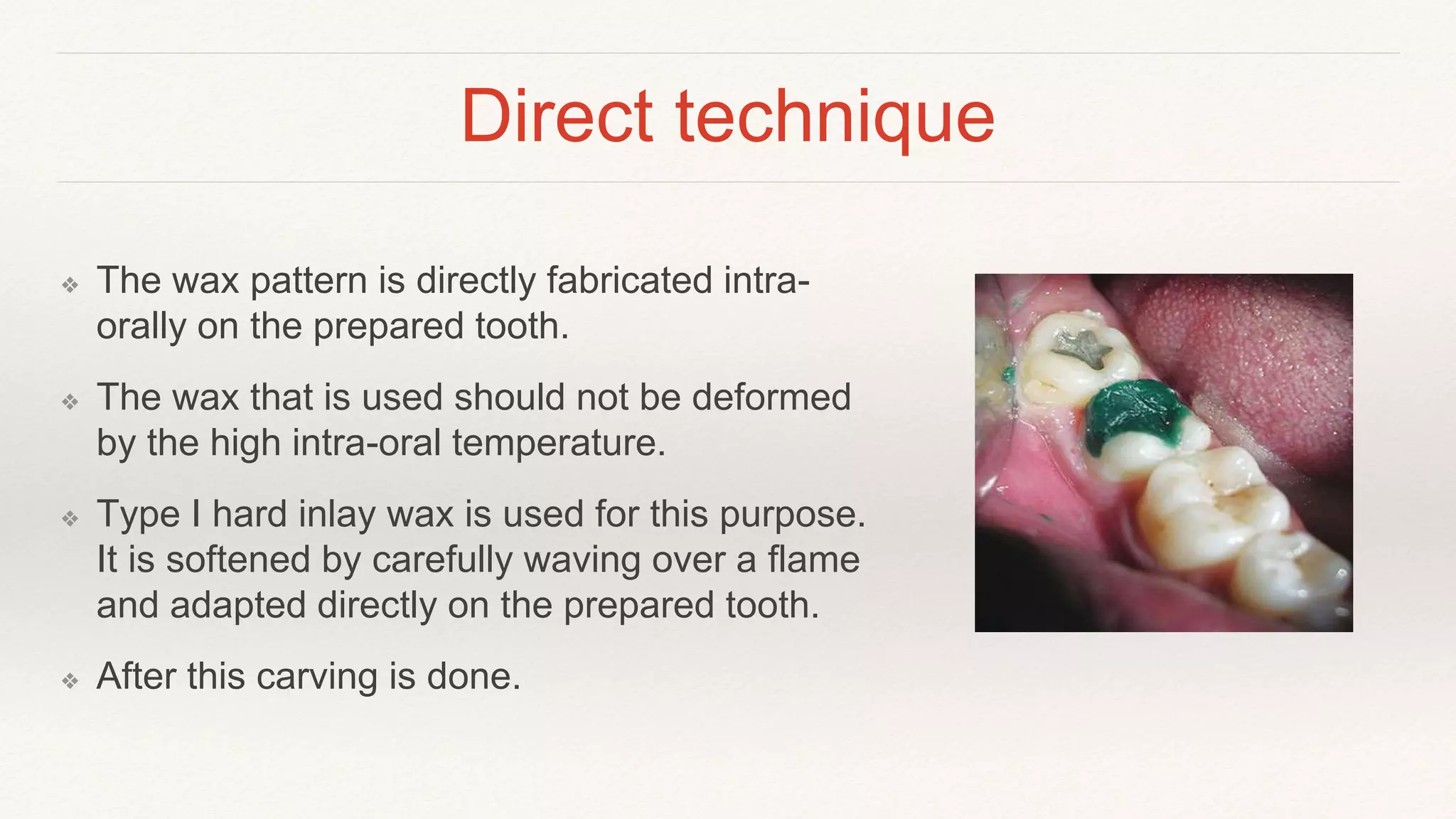Casting Procedures | PPTX
