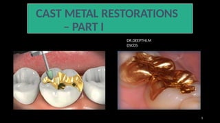 cast metal restorations ( inlay & onlay )in dentistry | PPTX