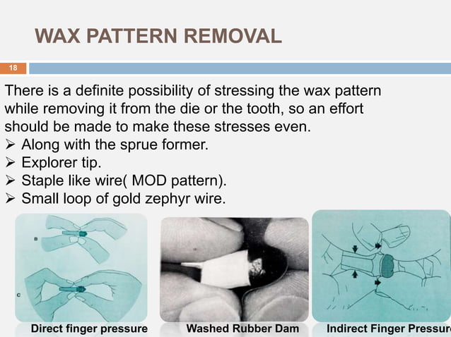Casting Procedures and Defects | PPTX