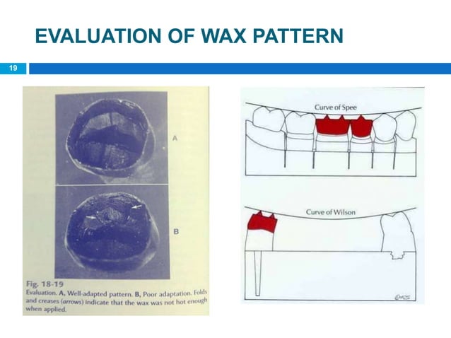 Casting Procedures and Defects | PPTX