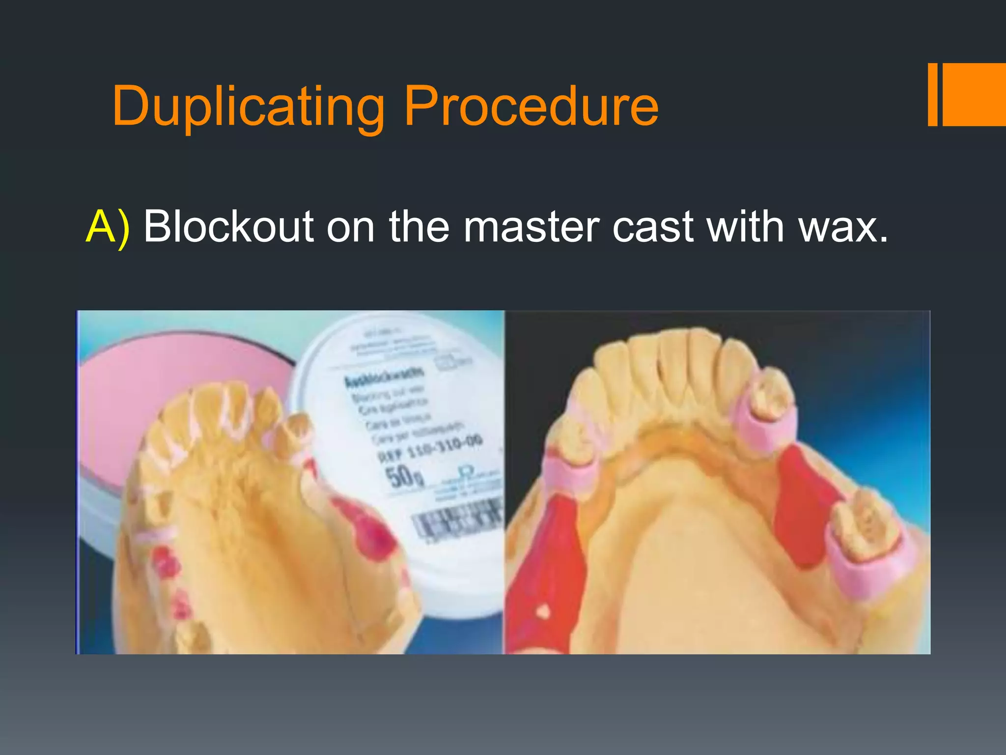 Casting Procedures in Dentistry | PPTX