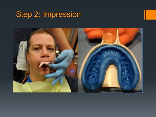 Casting Procedures in Dentistry | PPTX | Jewelry Making | Arts and Crafts