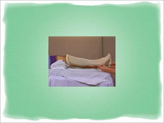 Casting and splinting | PPT