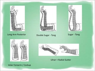 castingsplinting-200722004831 (1).pdf