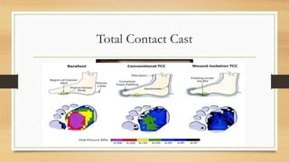 Casting splinting and bracing for wounds | PPT