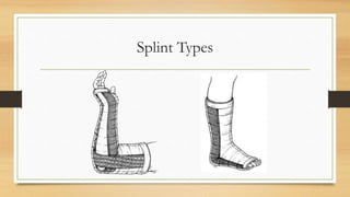 Casting splinting and bracing for wounds | PPT