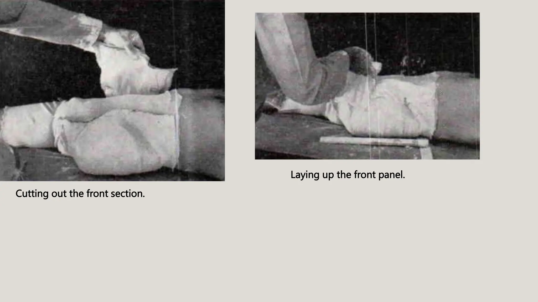 Casting Technique and Modification process of Hip Disarticulation.pptx