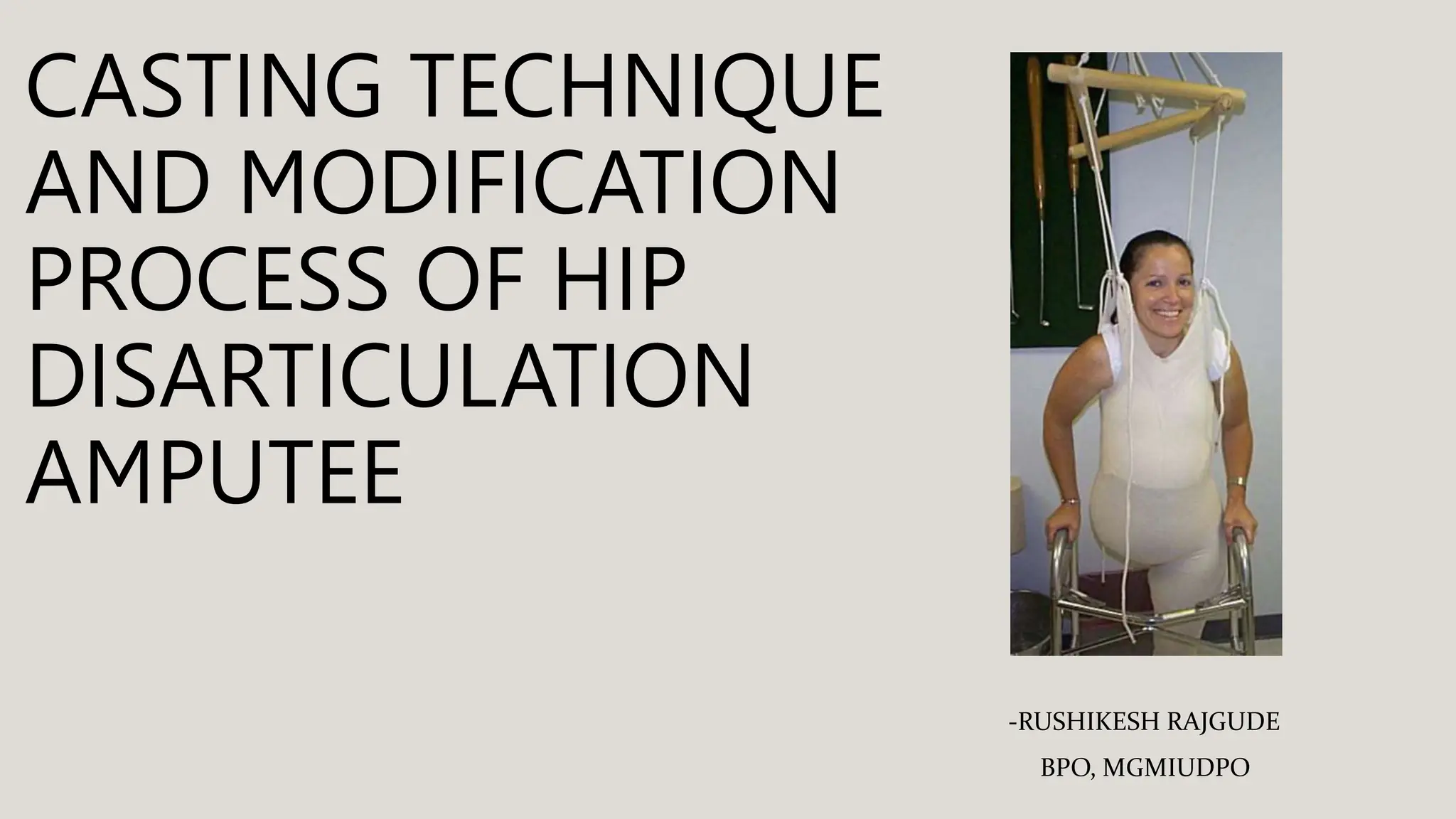 Casting Technique and Modification process of Hip Disarticulation.pptx