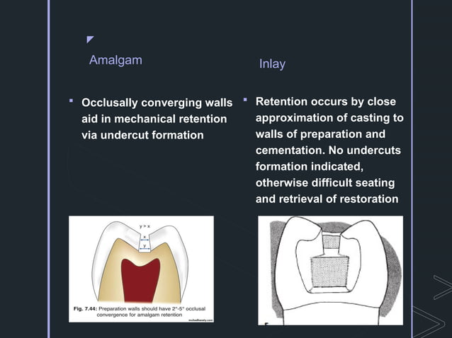 CAST METAL RESTORATIONS IN PROSTHODONTICS.pptx | Dental Health ...