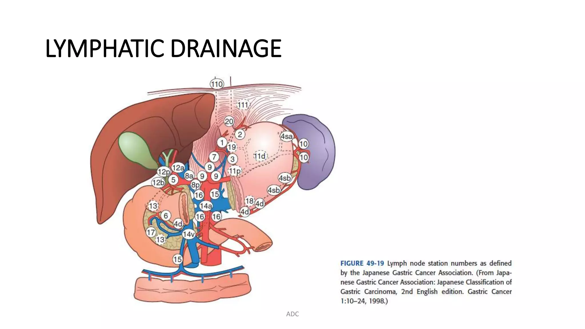 Carcinoma stomach | PPT