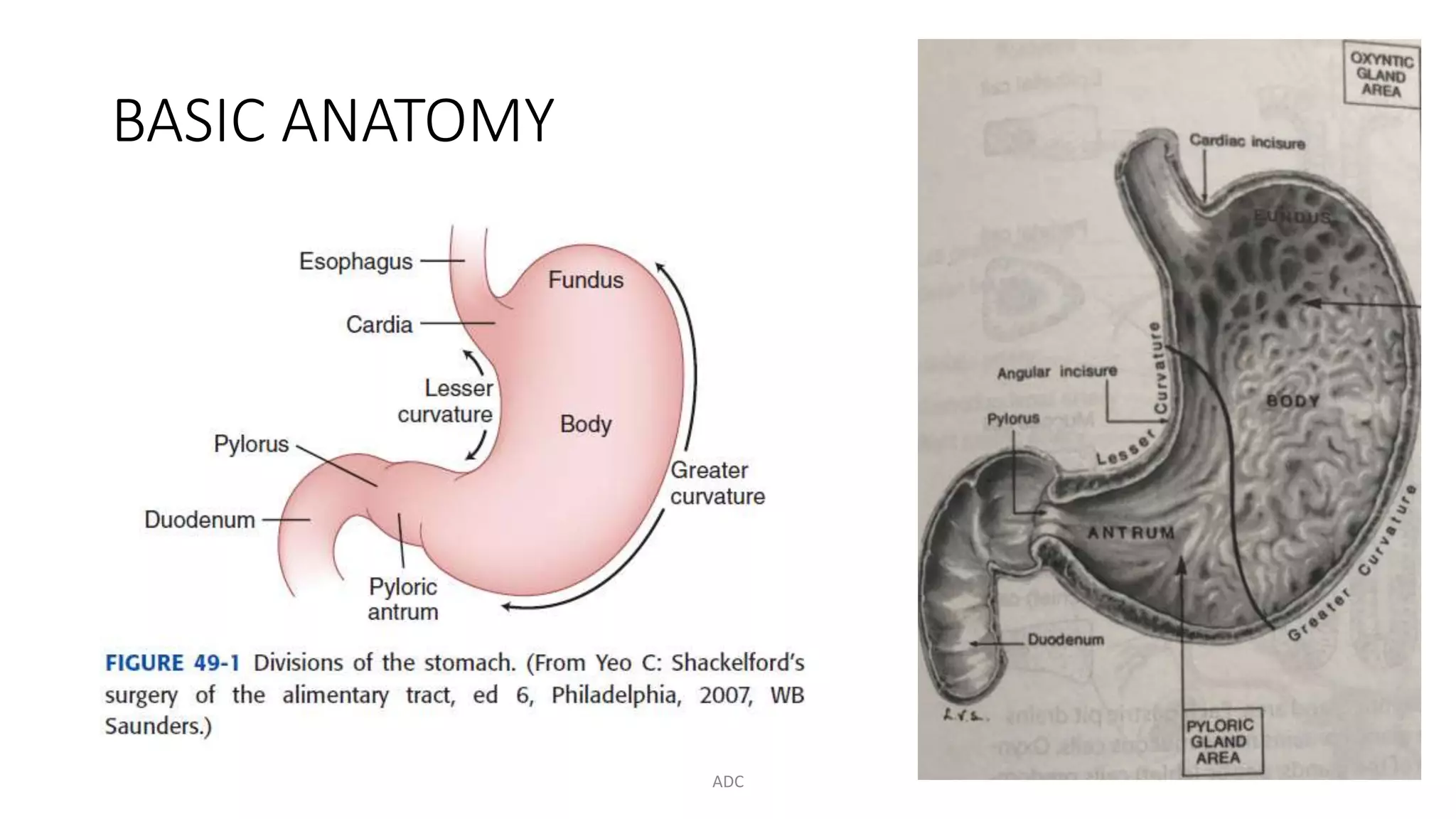 Carcinoma stomach | PPT