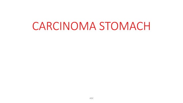Carcinoma stomach | PPT