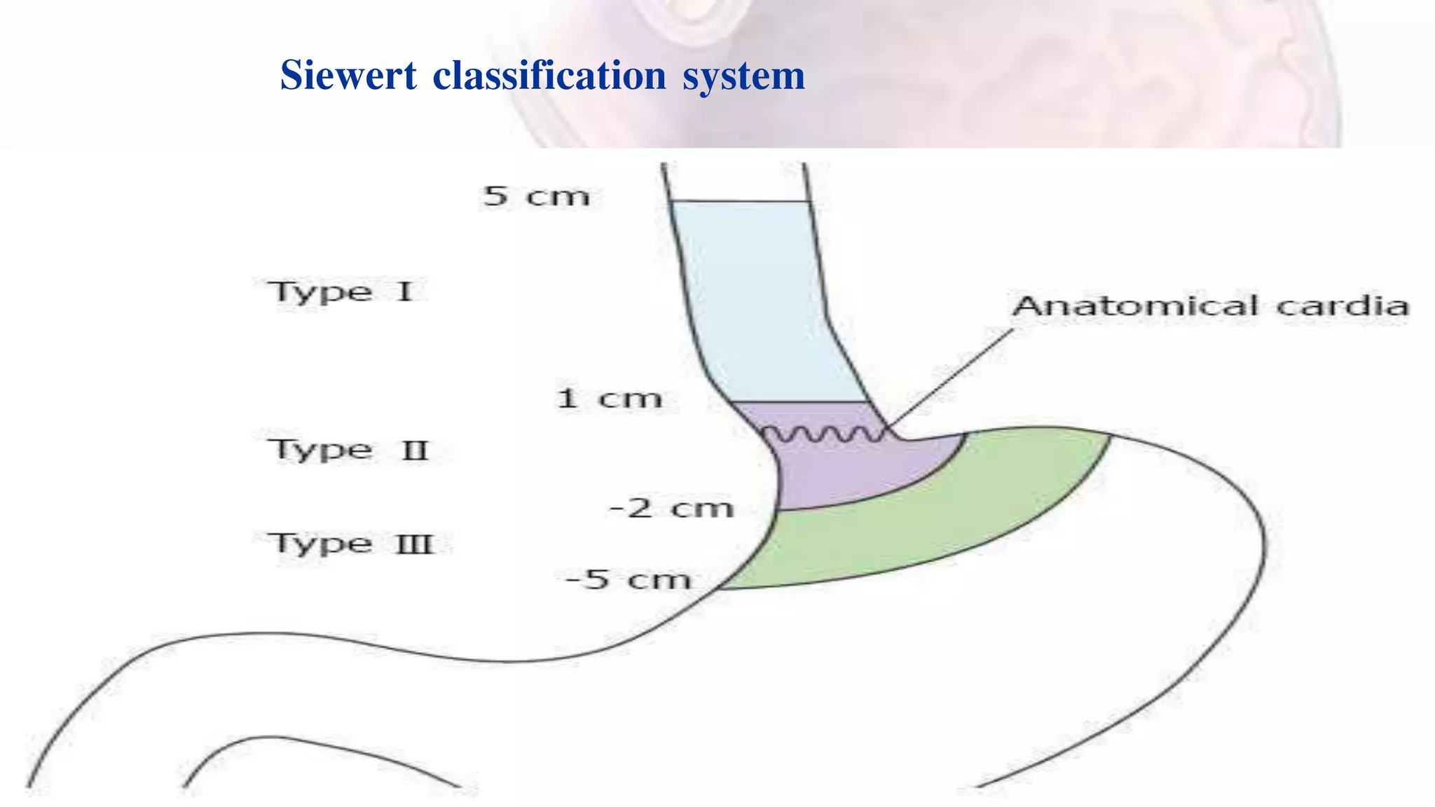 Gastric Carcinoma | PPTX