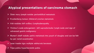 CA STOMACH.pptx