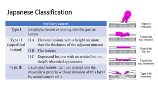 Stomach cancer | PPTX