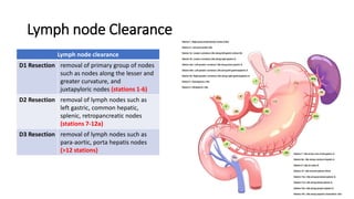 Stomach cancer | PPTX
