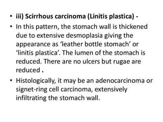 Carcinoma of stomach pathology. Ppt by | PDF