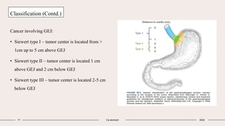 CARCINOMA STOMACH AND ITS MANAGEMENT DR DEEPTI.pptx