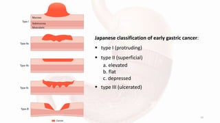 Carcinoma of Stomach ref on Bailey and Love (Seminar).pptx