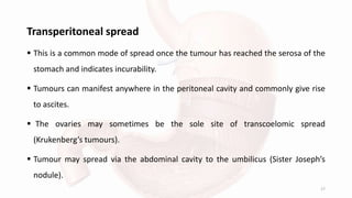 Carcinoma of Stomach ref on Bailey and Love (Seminar).pptx