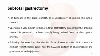 Carcinoma of Stomach ref on Bailey and Love (Seminar).pptx