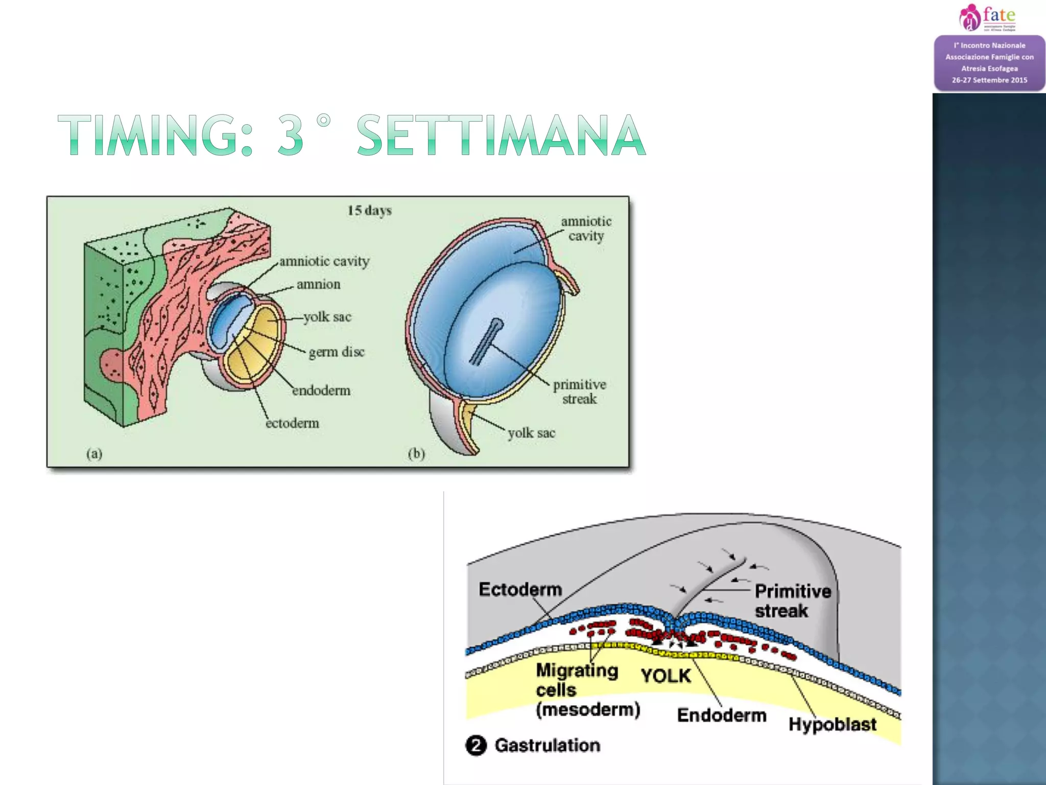 Atresia Esofagea - Ereditarietà, cause genetiche, sindromi associate | PDF