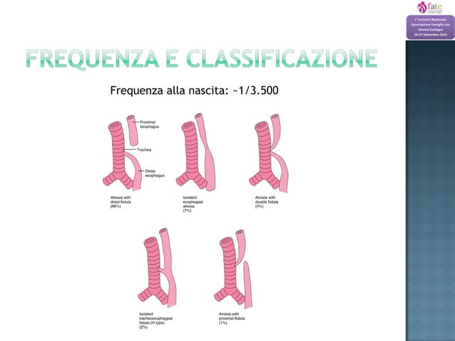 Atresia Esofagea - Ereditarietà, cause genetiche, sindromi associate | PDF