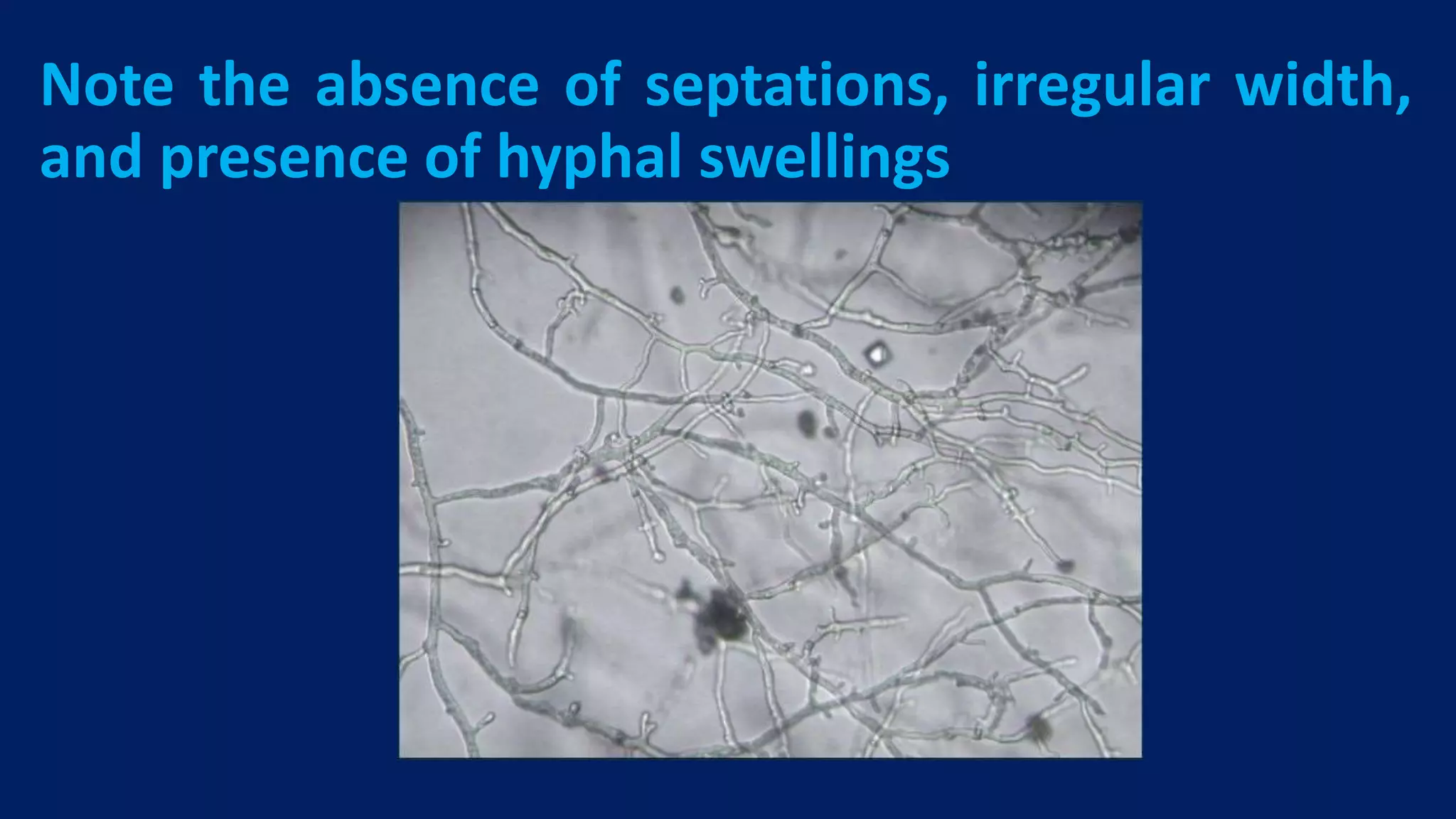 Phytophthora blight of Caster and Black shank of Tabocco | PPTX