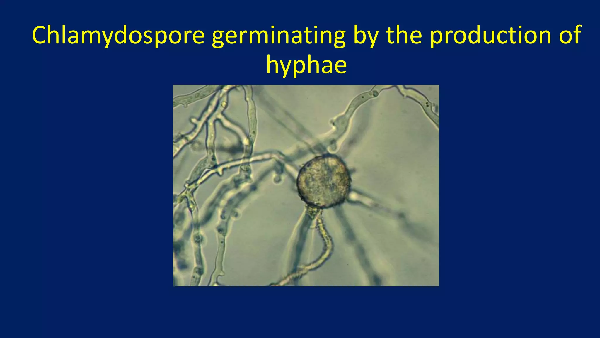 Phytophthora blight of Caster and Black shank of Tabocco | PPTX