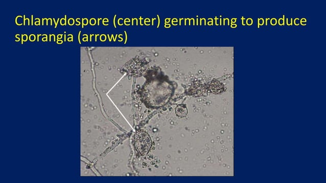Phytophthora blight of Caster and Black shank of Tabocco | PPTX