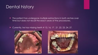 general case presentation in dentistry ppt | PPTX