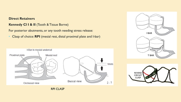 Cast partial denture design | PDF | Dental Health | Diseases and Conditions