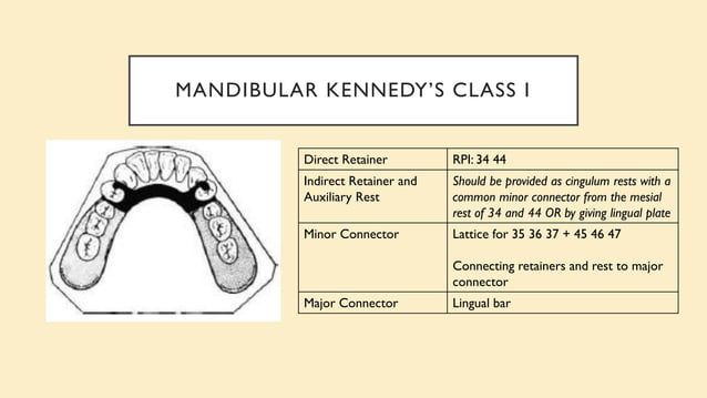 Cast partial denture design | PDF | Dental Health | Diseases and Conditions