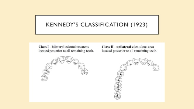 Cast partial denture design | PDF | Dental Health | Diseases and Conditions