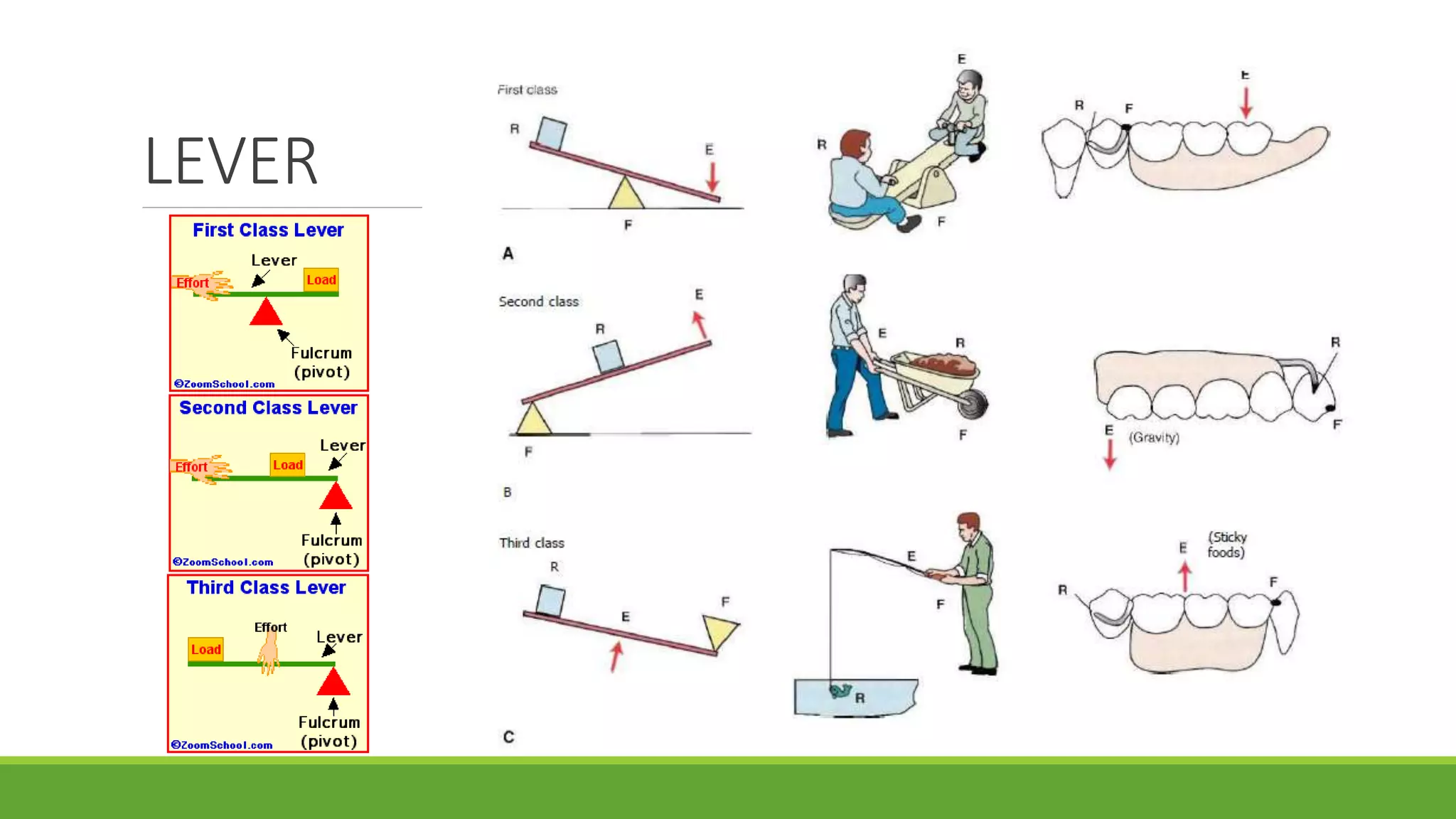BASIC PRINCIPLES AND FUNDAMENTALS OF CAST PARTIAL DENTURE DESIGNING | PPTX