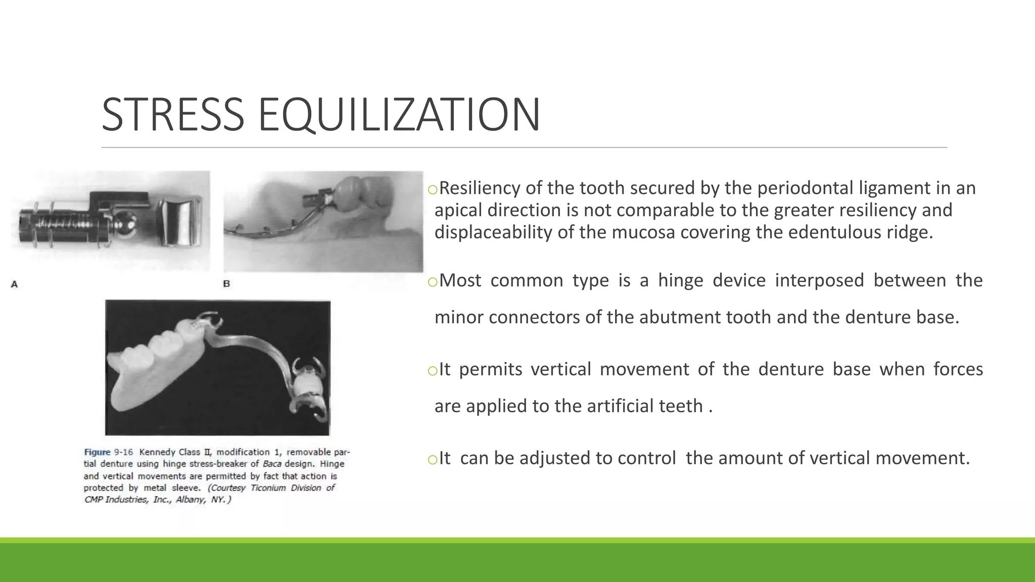 BASIC PRINCIPLES AND FUNDAMENTALS OF CAST PARTIAL DENTURE DESIGNING | PPTX