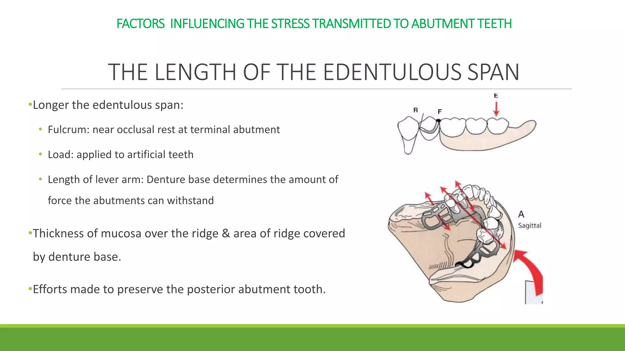 BASIC PRINCIPLES AND FUNDAMENTALS OF CAST PARTIAL DENTURE DESIGNING | PPTX