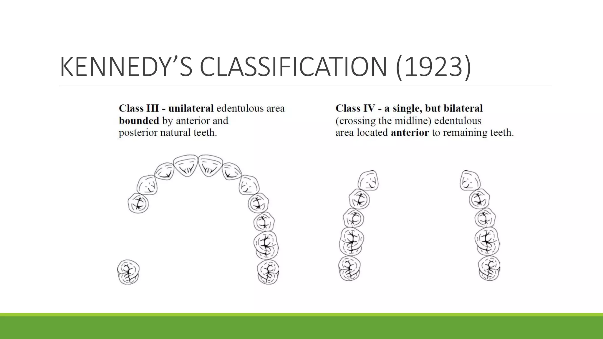 BASIC PRINCIPLES AND FUNDAMENTALS OF CAST PARTIAL DENTURE DESIGNING | PPTX