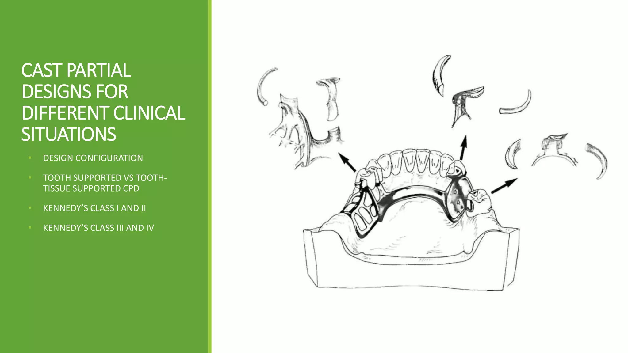 BASIC PRINCIPLES AND FUNDAMENTALS OF CAST PARTIAL DENTURE DESIGNING | PPTX