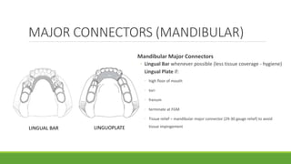 BASIC PRINCIPLES AND FUNDAMENTALS OF CAST PARTIAL DENTURE DESIGNING | PPTX