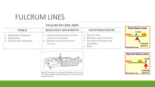 BASIC PRINCIPLES AND FUNDAMENTALS OF CAST PARTIAL DENTURE DESIGNING | PPTX