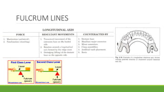 BASIC PRINCIPLES AND FUNDAMENTALS OF CAST PARTIAL DENTURE DESIGNING | PPTX
