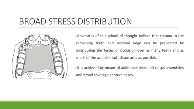 BASIC PRINCIPLES AND FUNDAMENTALS OF CAST PARTIAL DENTURE DESIGNING | PPTX