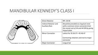 BASIC PRINCIPLES AND FUNDAMENTALS OF CAST PARTIAL DENTURE DESIGNING | PPTX