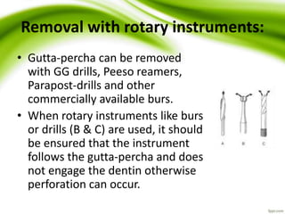 Custom made post & Core in endodontics | PPTX