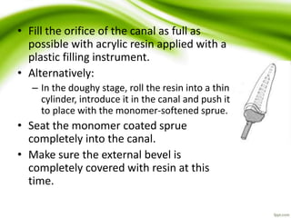 Custom made post & Core in endodontics | PPTX