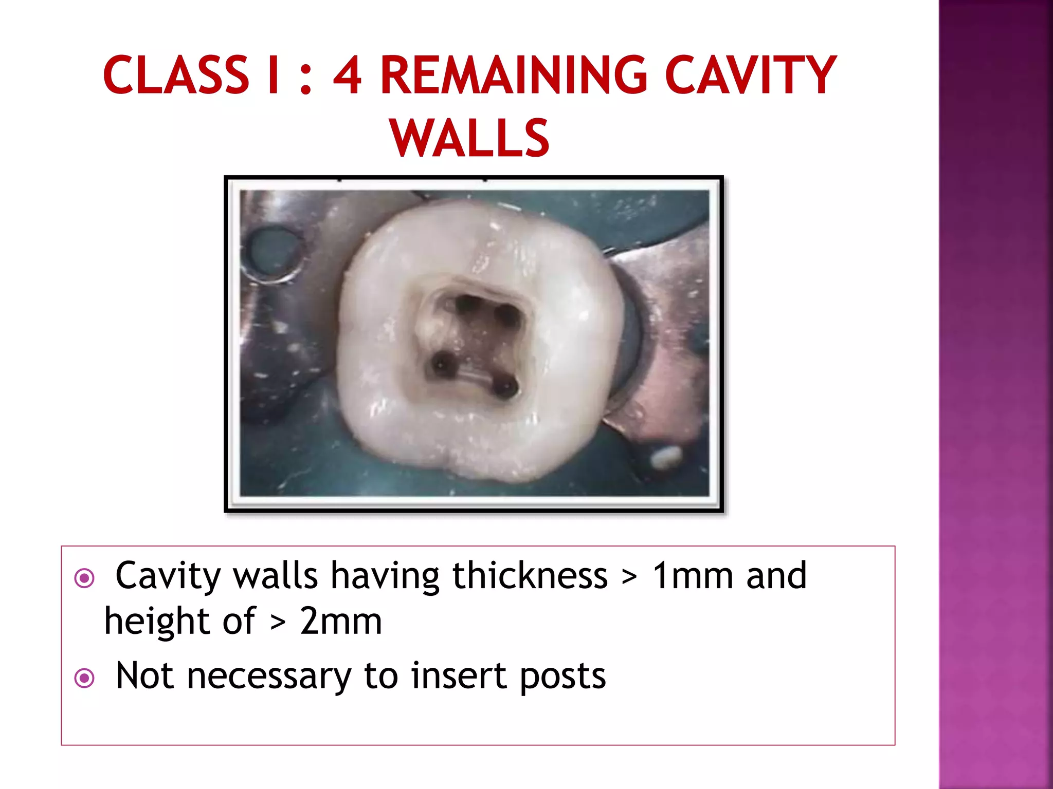 Cast post - Restoration of endodontically treated teeth | PPTX